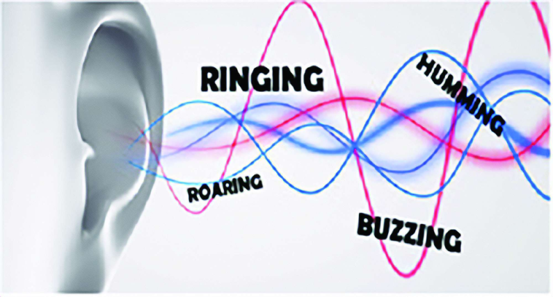 Do hearing aids help with ringing in the ears? | Audiology South