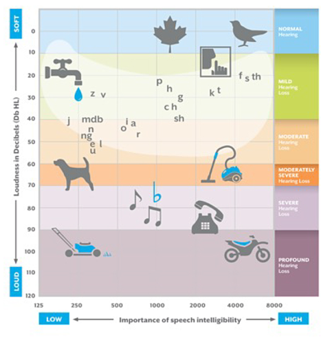 Ever wondered how to read an audiogram? | Audiology South