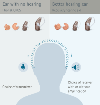 Hearing ‘from both sides’ has well-being benefits | Audiology South