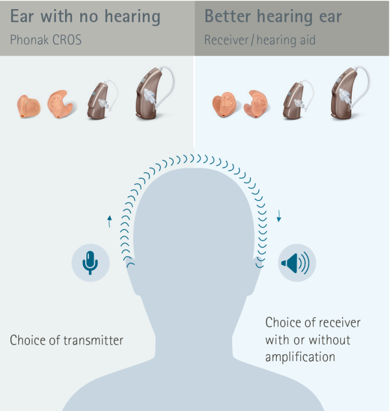 Hearing ‘from both sides’ has well-being benefits | Audiology South